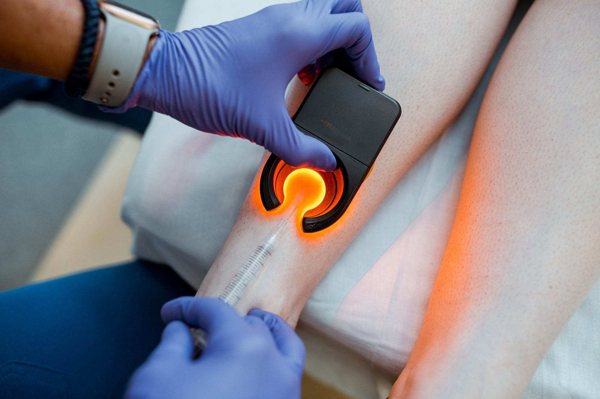 Vascular & Vein Care Services | Pinehurst Surgical Clinic